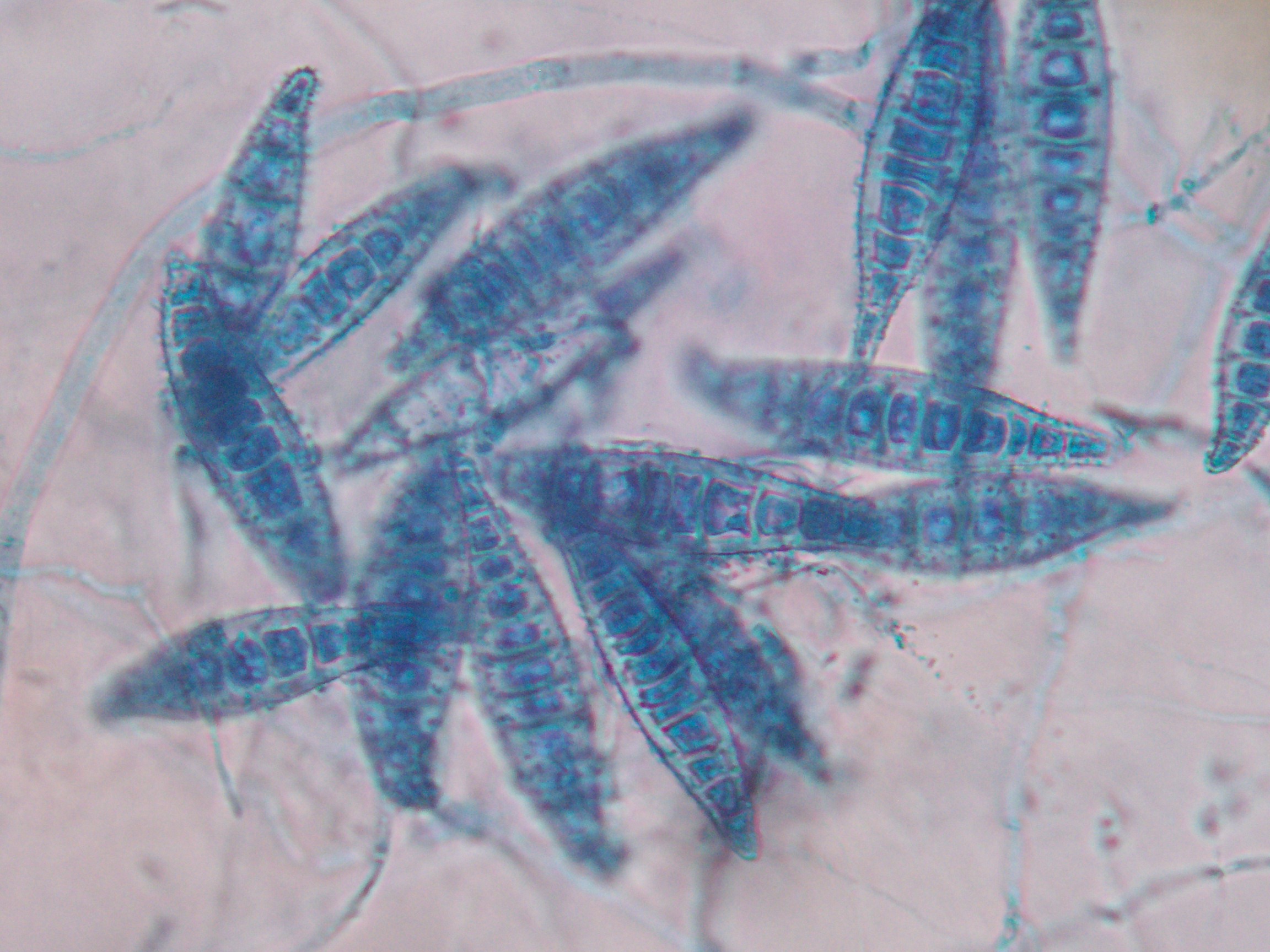 Dermatofito microsporum canis - Orden En Casa Y Mascotas